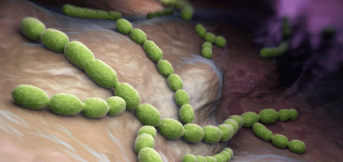 Pneumococcal (Pneumonia): Symptoms, Treatment & Prevention - Toronto ...